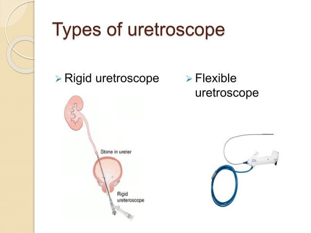 Cystoscopy | PPTX