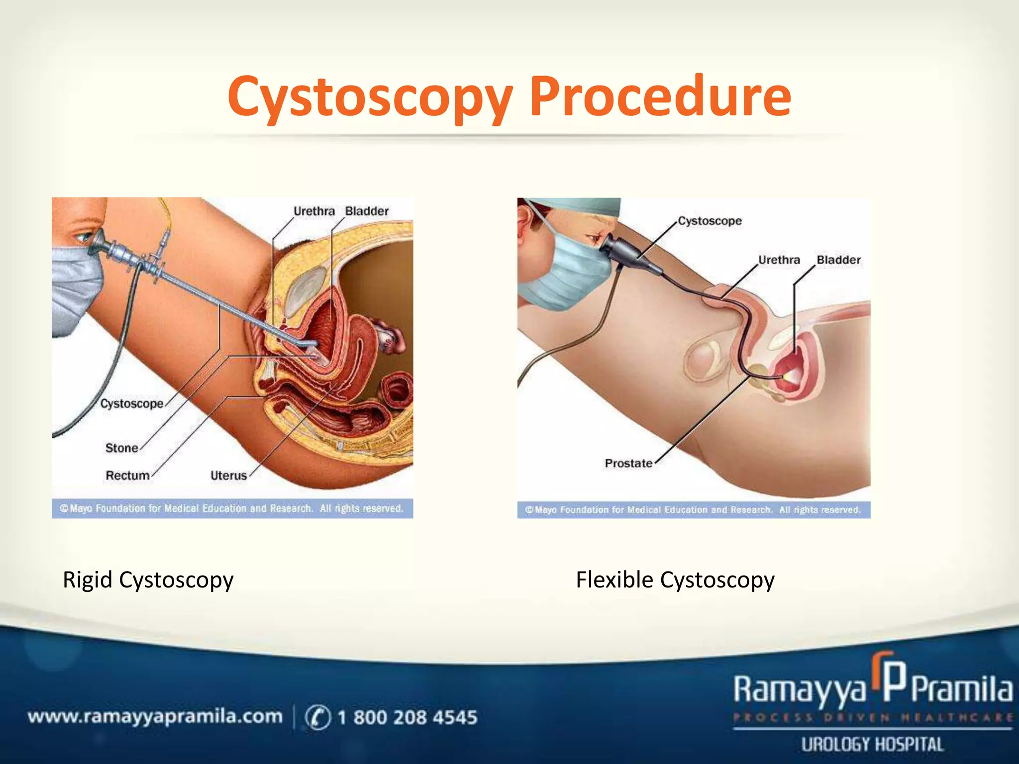 Cystoscopy /uretroscopy | PPTX