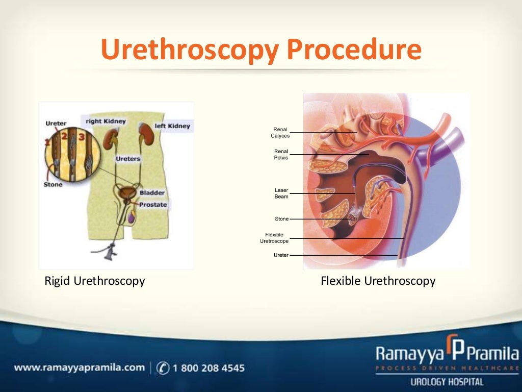 Cystoscopy /uretroscopy