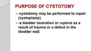 Cystotomy | PPT