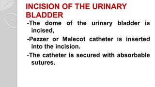 Cystotomy | PPT