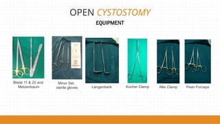 OPTEK ILMIAH CYSTOTOMY BEDAH UROLOGI.pptx