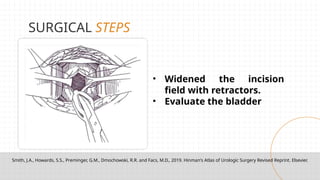 OPTEK ILMIAH CYSTOTOMY BEDAH UROLOGI.pptx