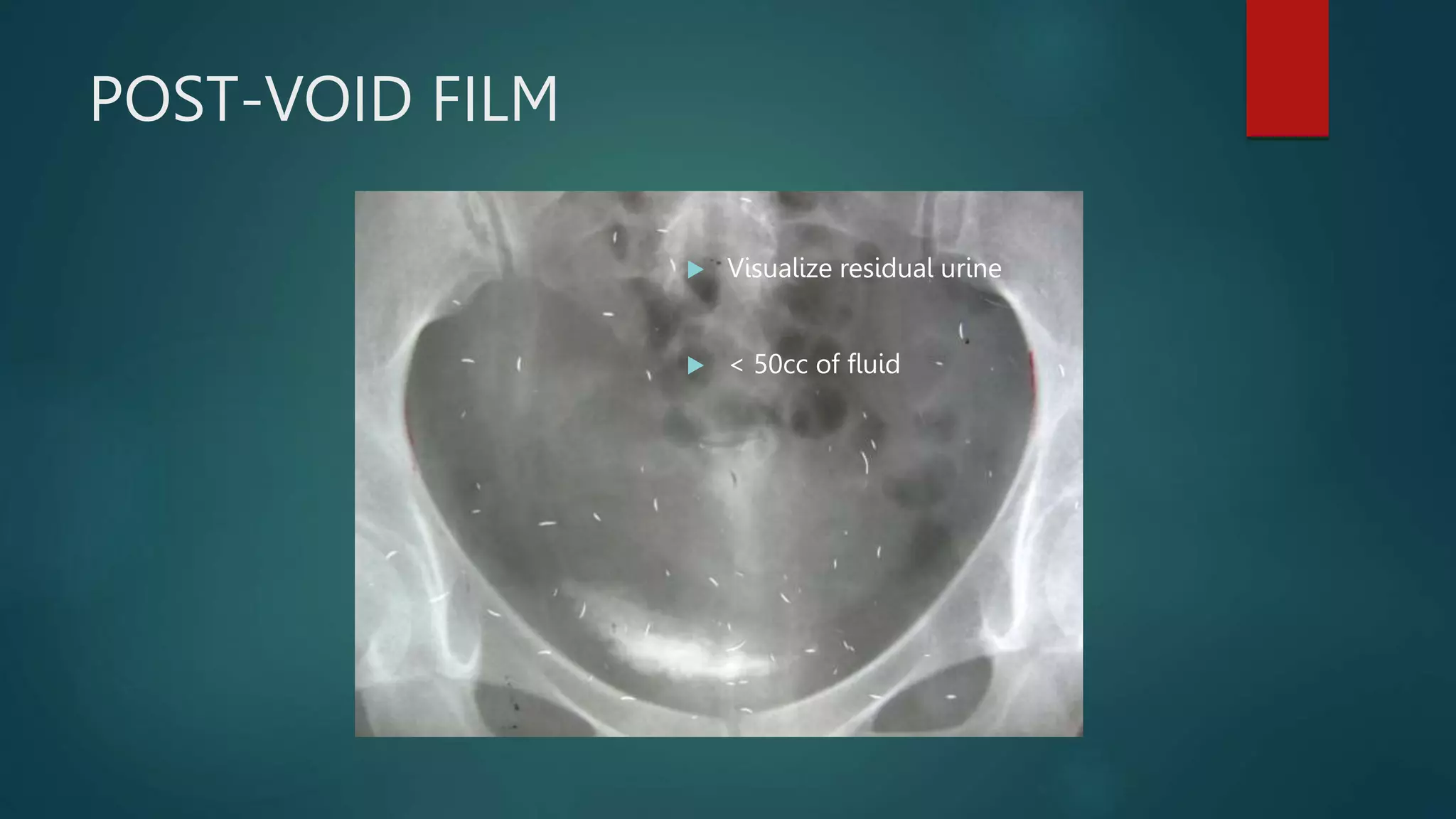 Cystourethrography - Lecture.pptx
