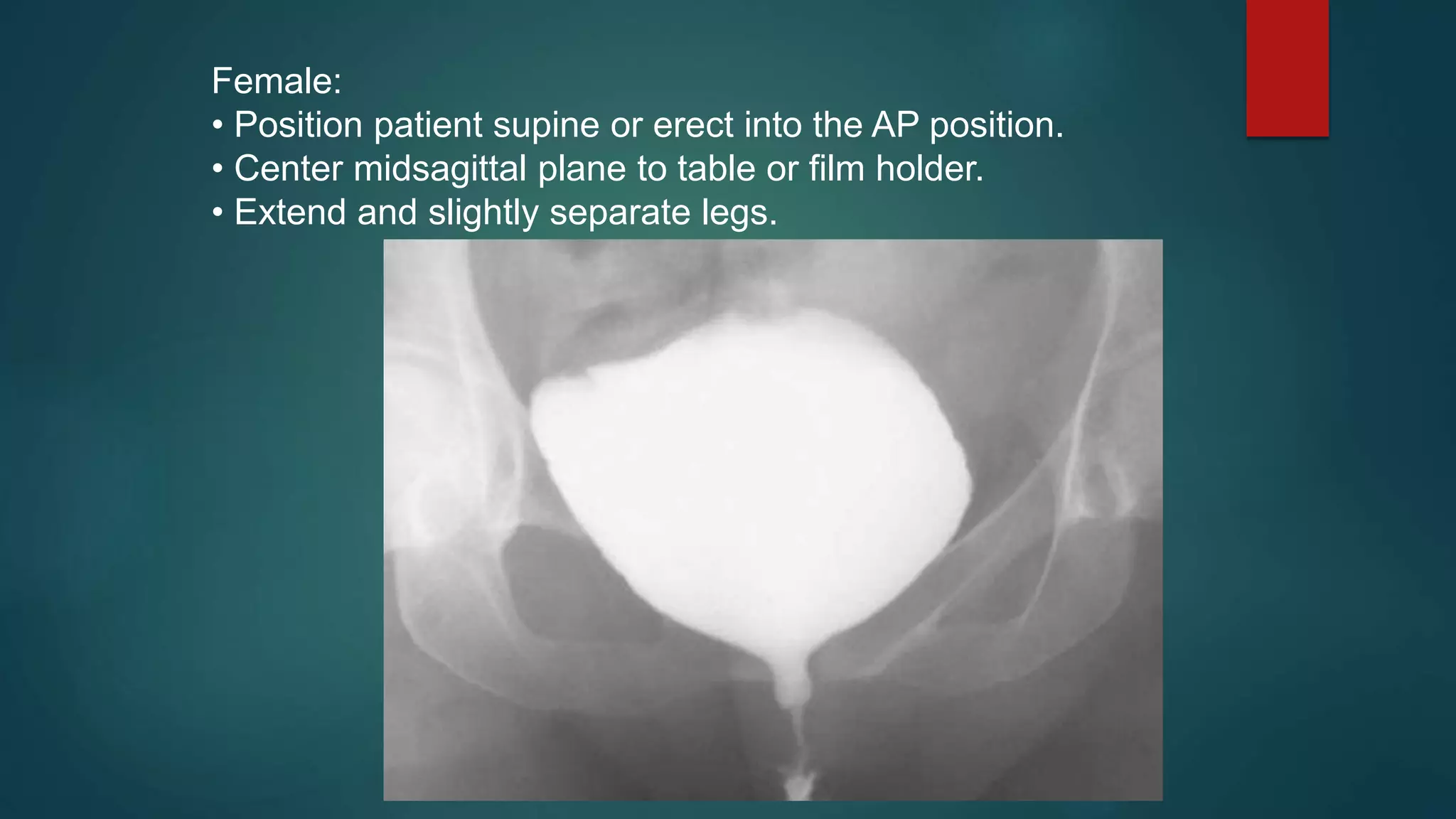 Cystourethrography - Lecture.pptx