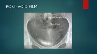 Cystourethrography - Lecture.pptx