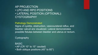 Cystourethrography - Lecture.pptx