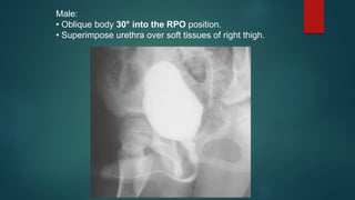 Cystourethrography - Lecture.pptx