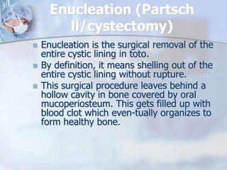 cysts of the jaws | PPTX