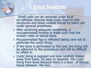 cysts of the jaws | PPTX