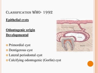 Cysts of jaw | PDF