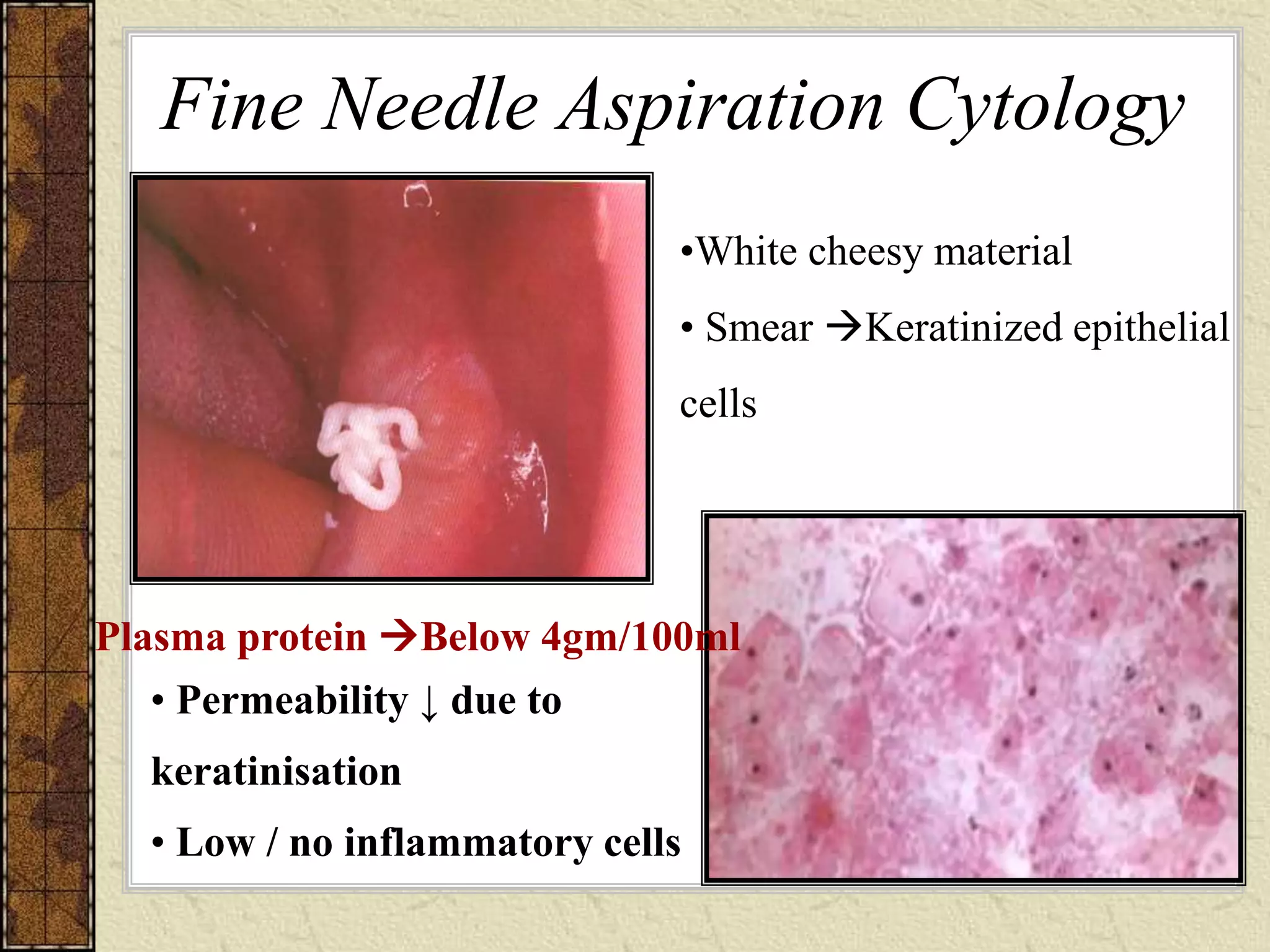 Cysts.ppt