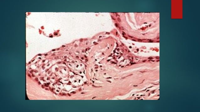 Odontogenic Cysts And Tumors Or Oral Cavity Ppt