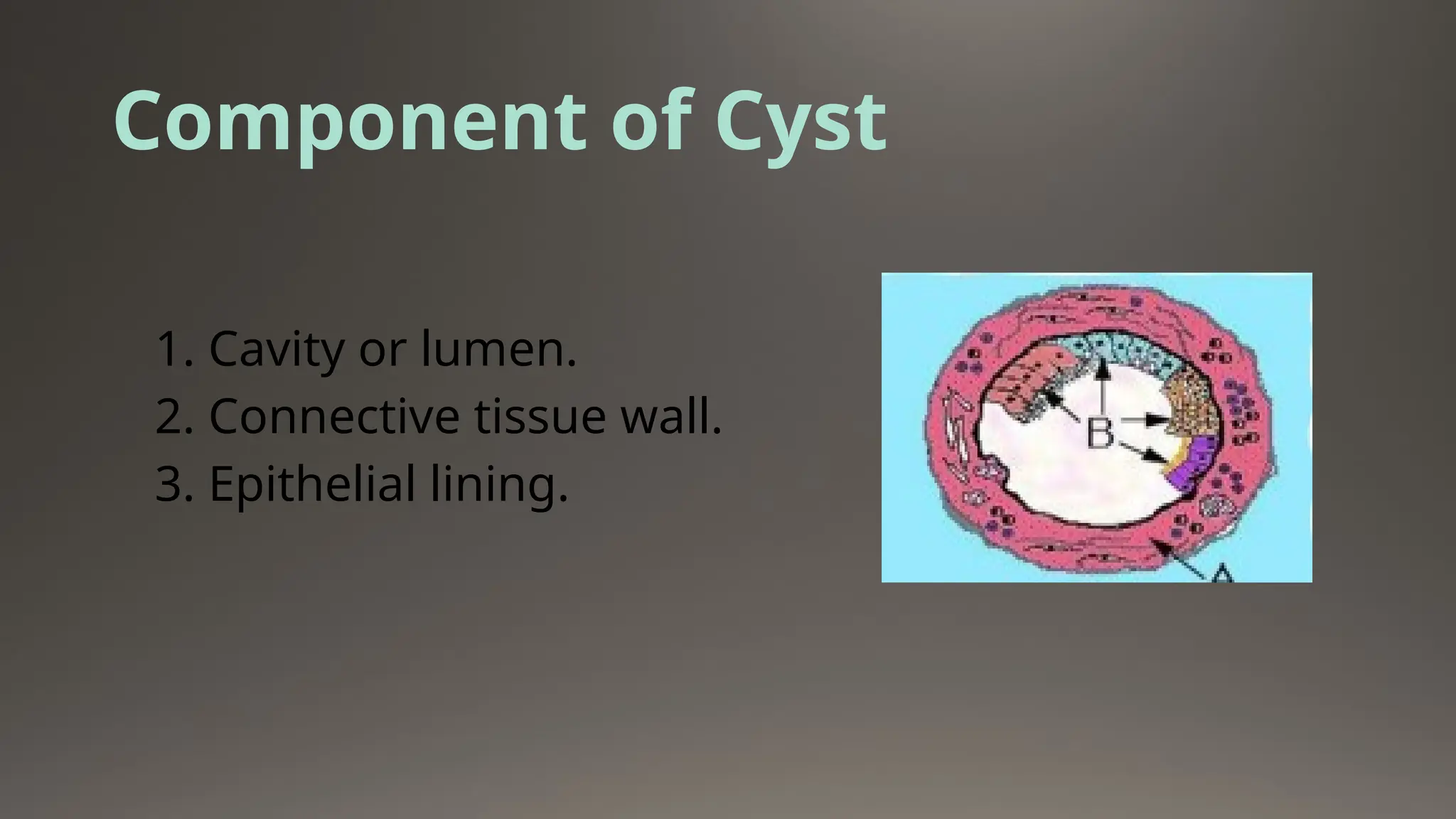 CystS in oral pathology dental edu[1].pptx