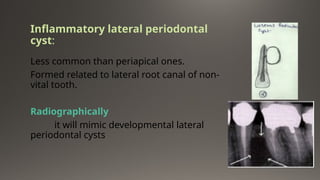 CystS in oral pathology dental edu[1].pptx