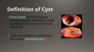 CystS in oral pathology dental edu[1].pptx