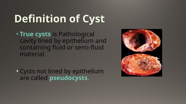 CystS in oral pathology dental edu[1].pptx