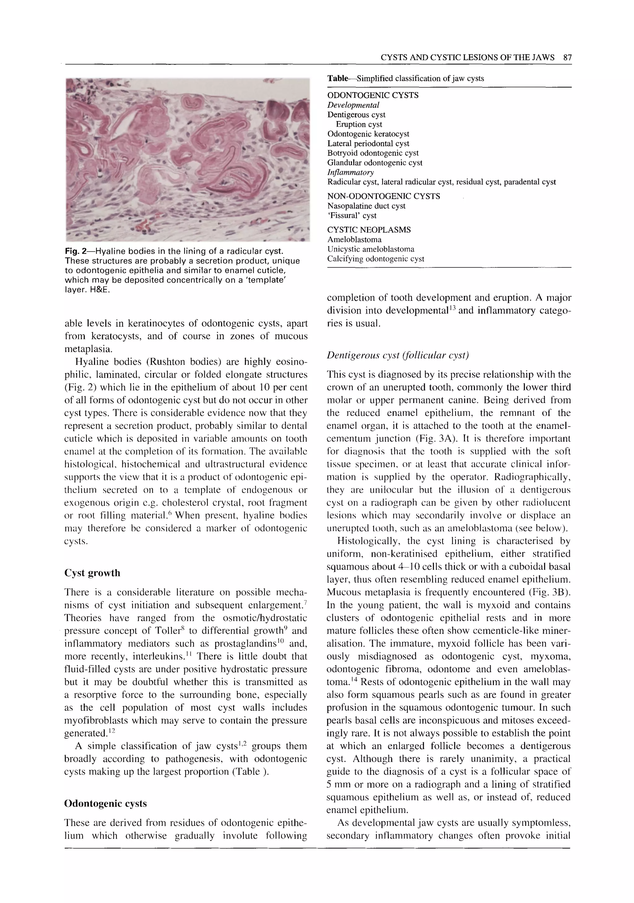 Cysts and cystic lesions | PDF