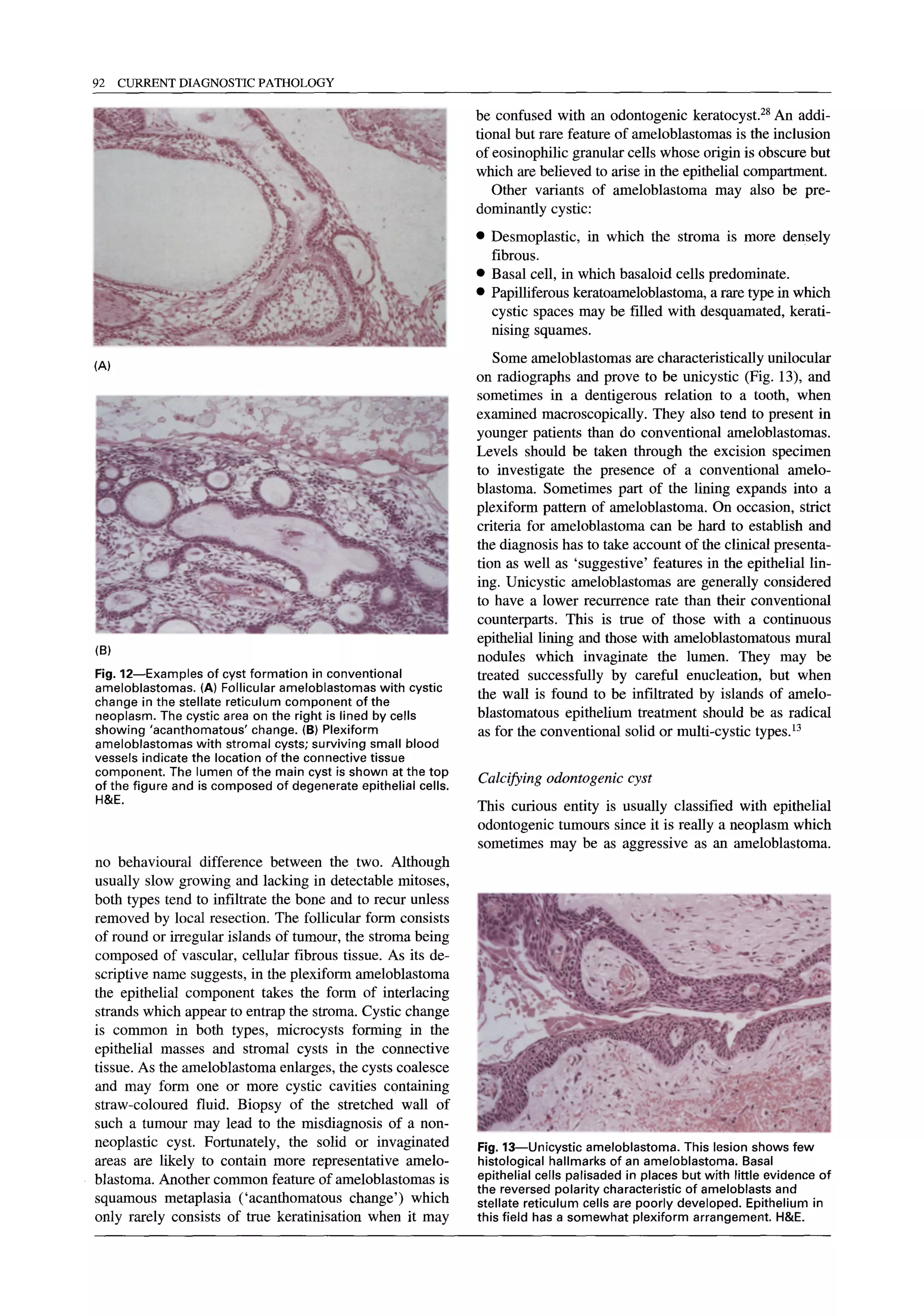 Cysts and cystic lesions | PDF