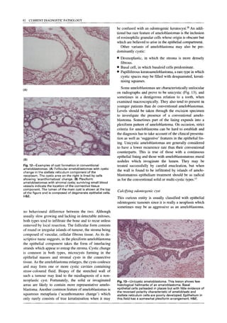 Cysts and cystic lesions | PDF