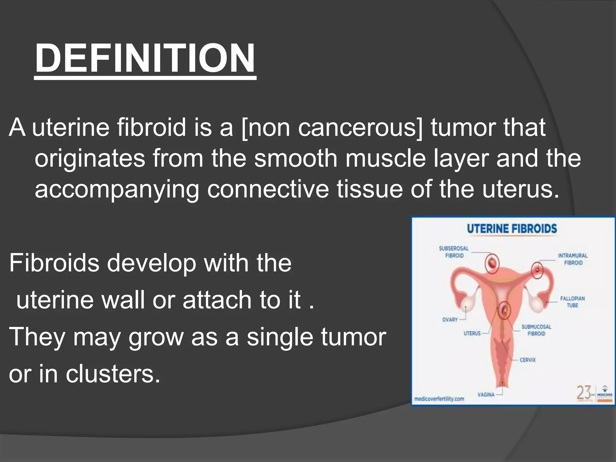Cysts and fibroids | PPTX