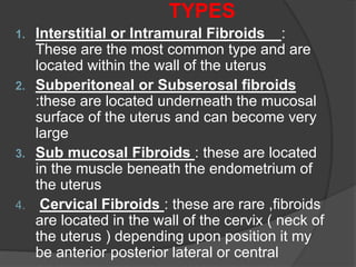 Cysts and fibroids | PPTX