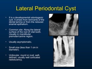Cysts and Odontogenic tumors | PPT