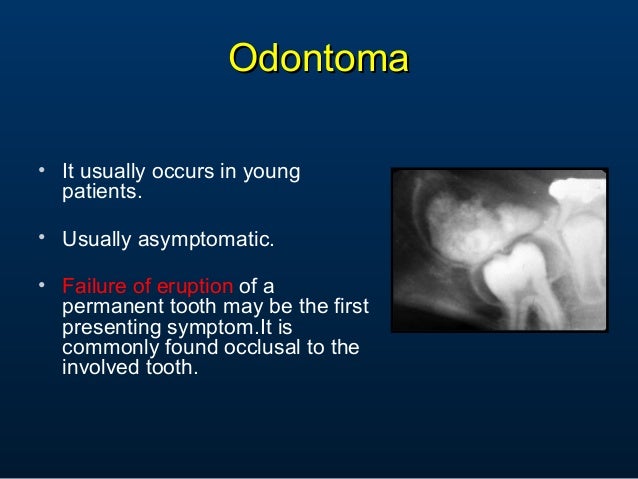 Cysts And Odontogenic Tumors