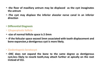 Cysts in children | PPTX