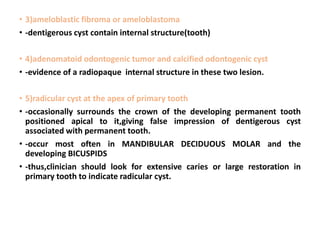Cysts in children | PPTX
