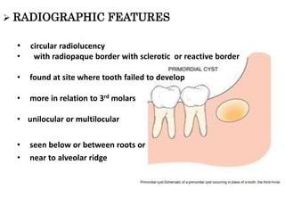Cysts in children | PPTX