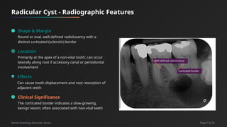 Cysts in Dental Radiography_ Classification and Radiographic Features.pptx