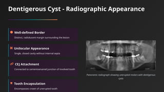 Cysts in Dental Radiography_ Classification and Radiographic Features.pptx