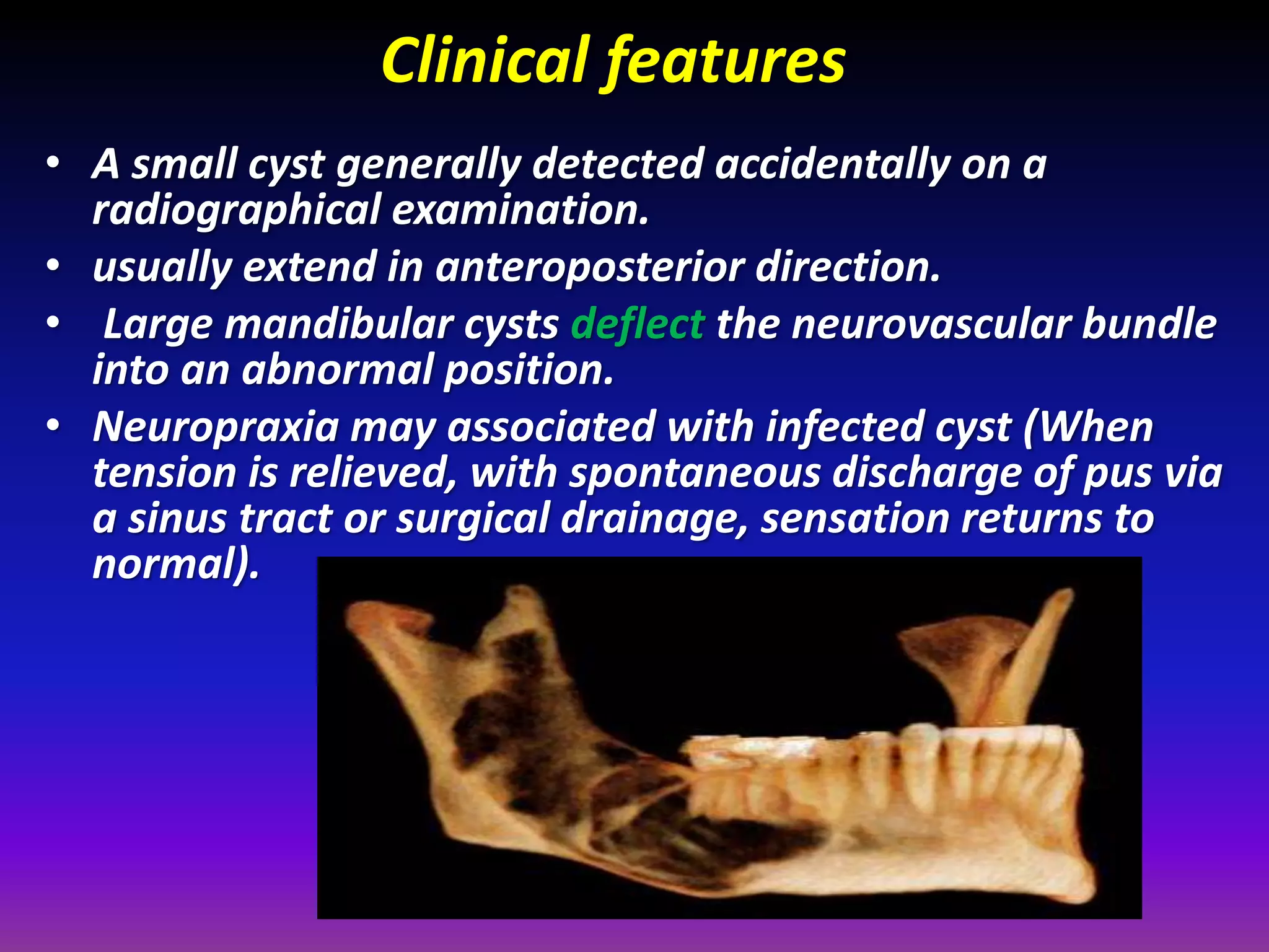 Cysts in orofacial region | PPSX