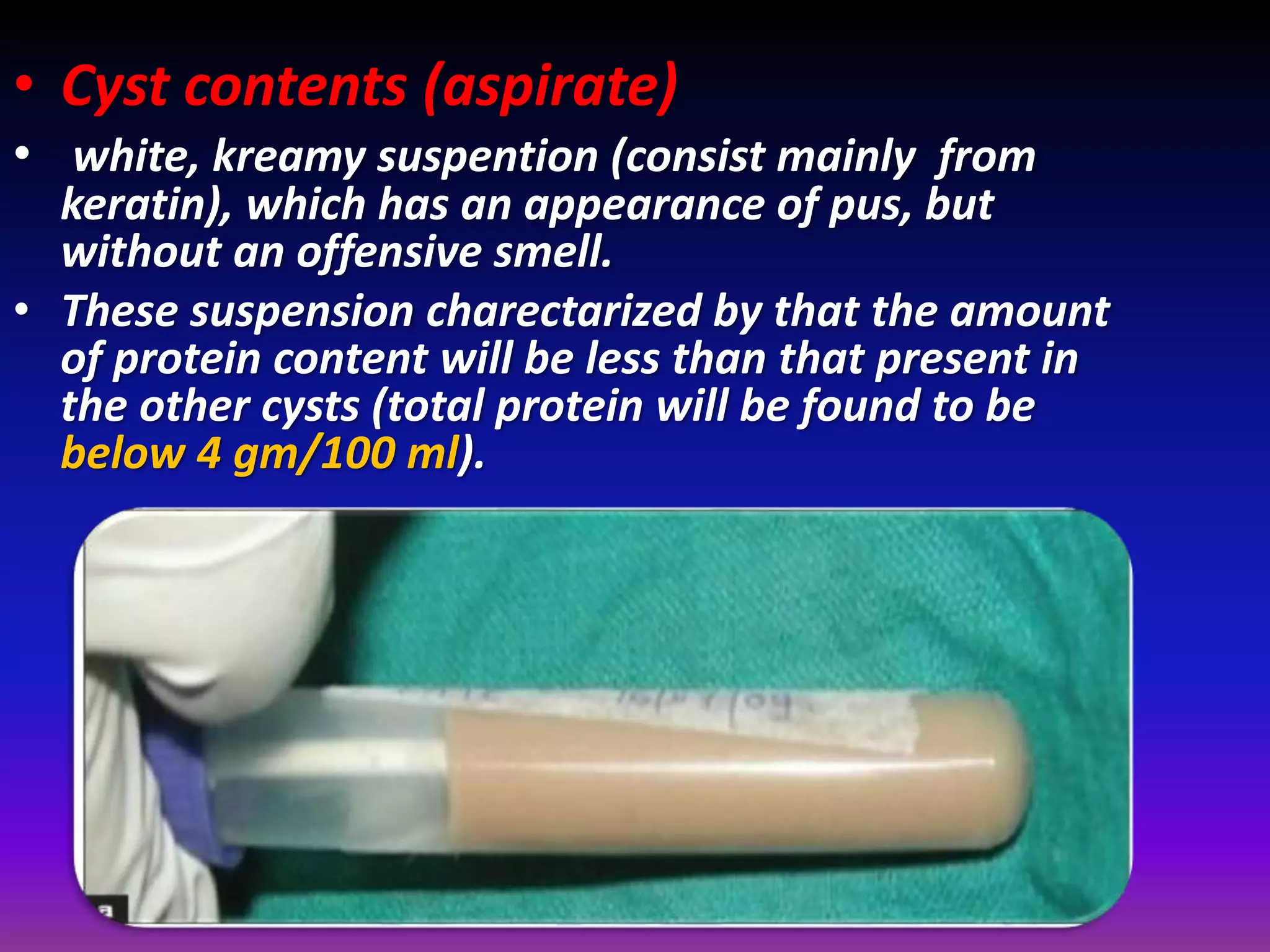 Cysts in orofacial region | PPSX