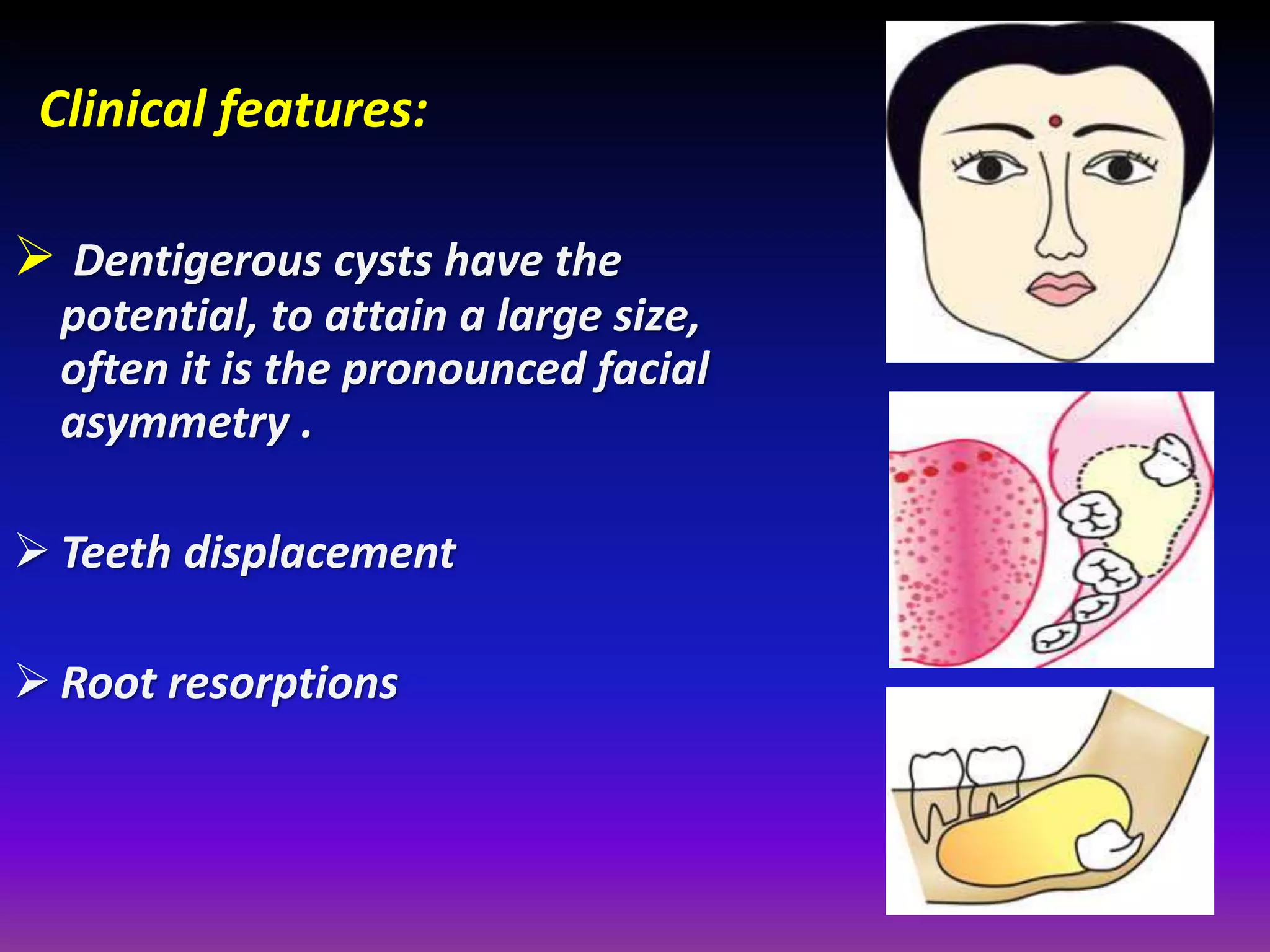 Cysts in orofacial region | PPSX