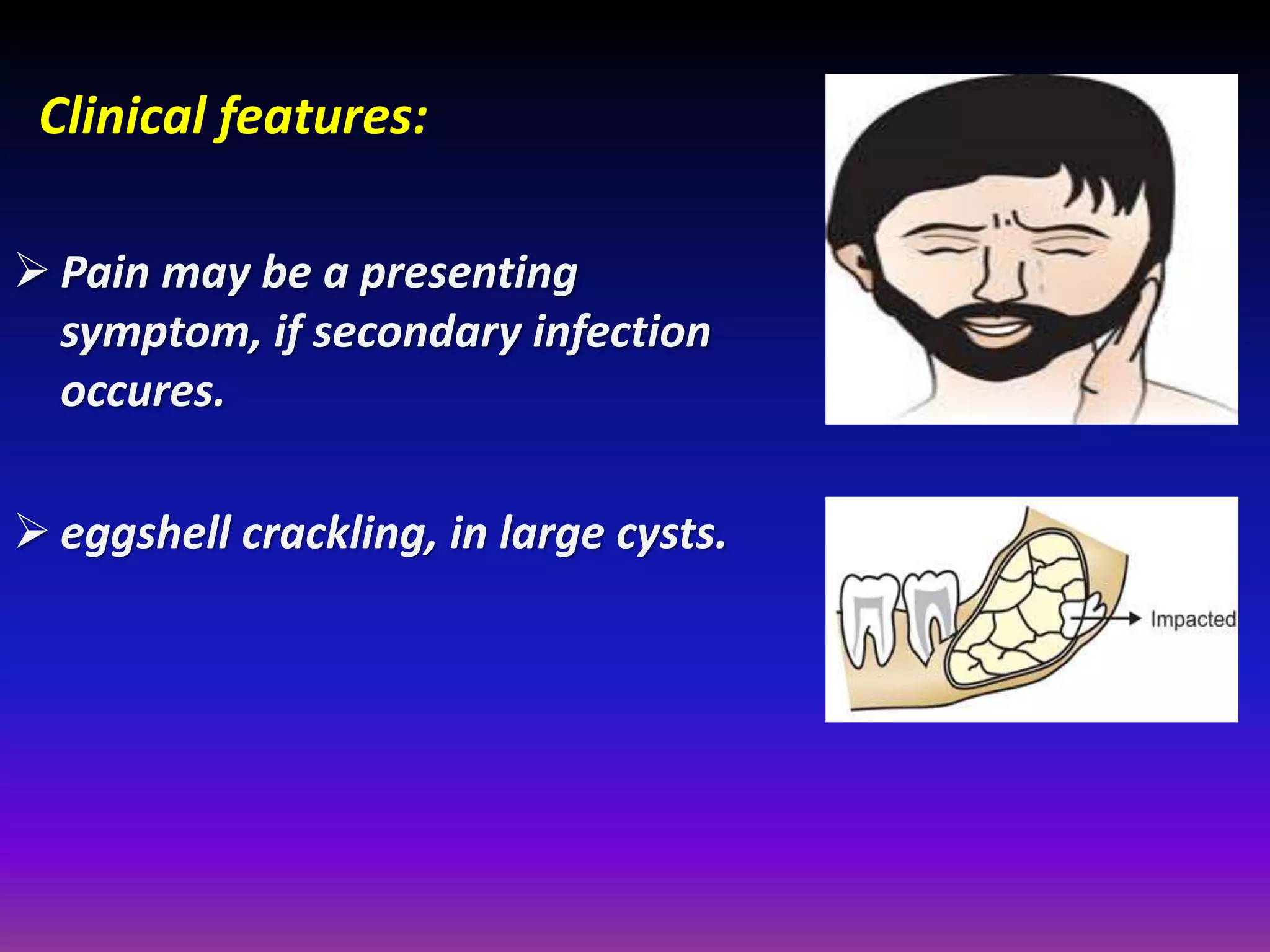 Cysts in orofacial region | PPSX