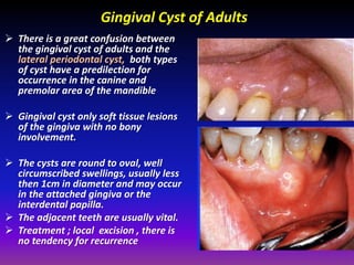 Cysts in orofacial region | PPT