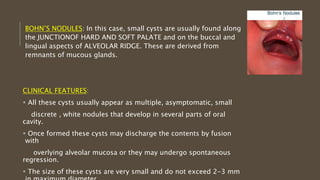 CYSTS OF HEAD AND NECK | PPTX