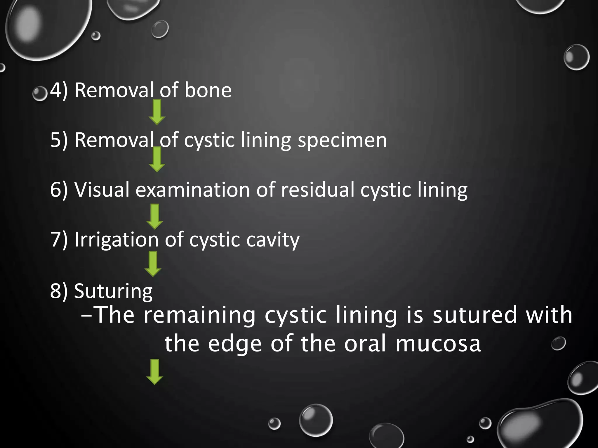 Cysts of jaw- management oral and maxillofacial surgery | PPTX