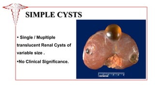 Cysts of kidney | PPTX
