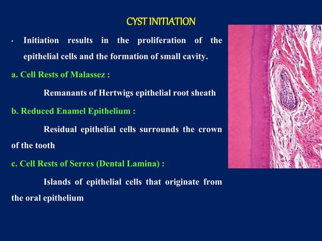 cysts of oral and maxillofacial region.pdf