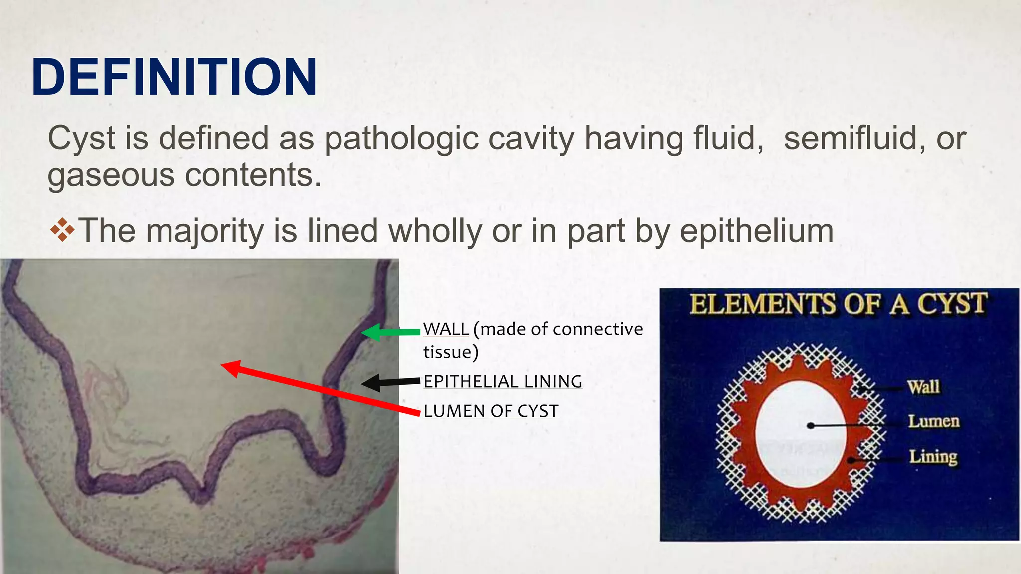 Cysts of oral and maxillofacial region by dr. maryam salman | PPTX