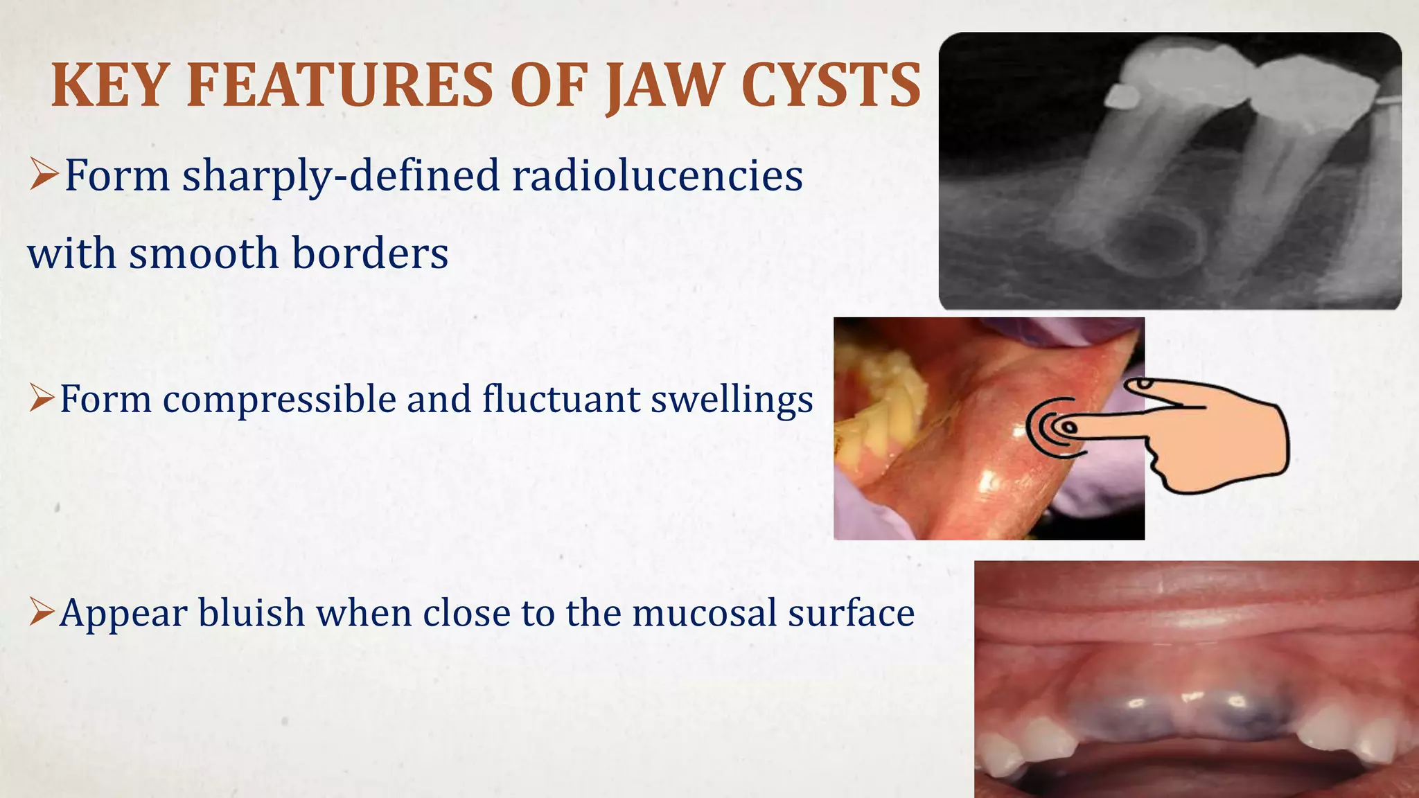 Cysts of oral and maxillofacial region by dr. maryam salman | PPTX