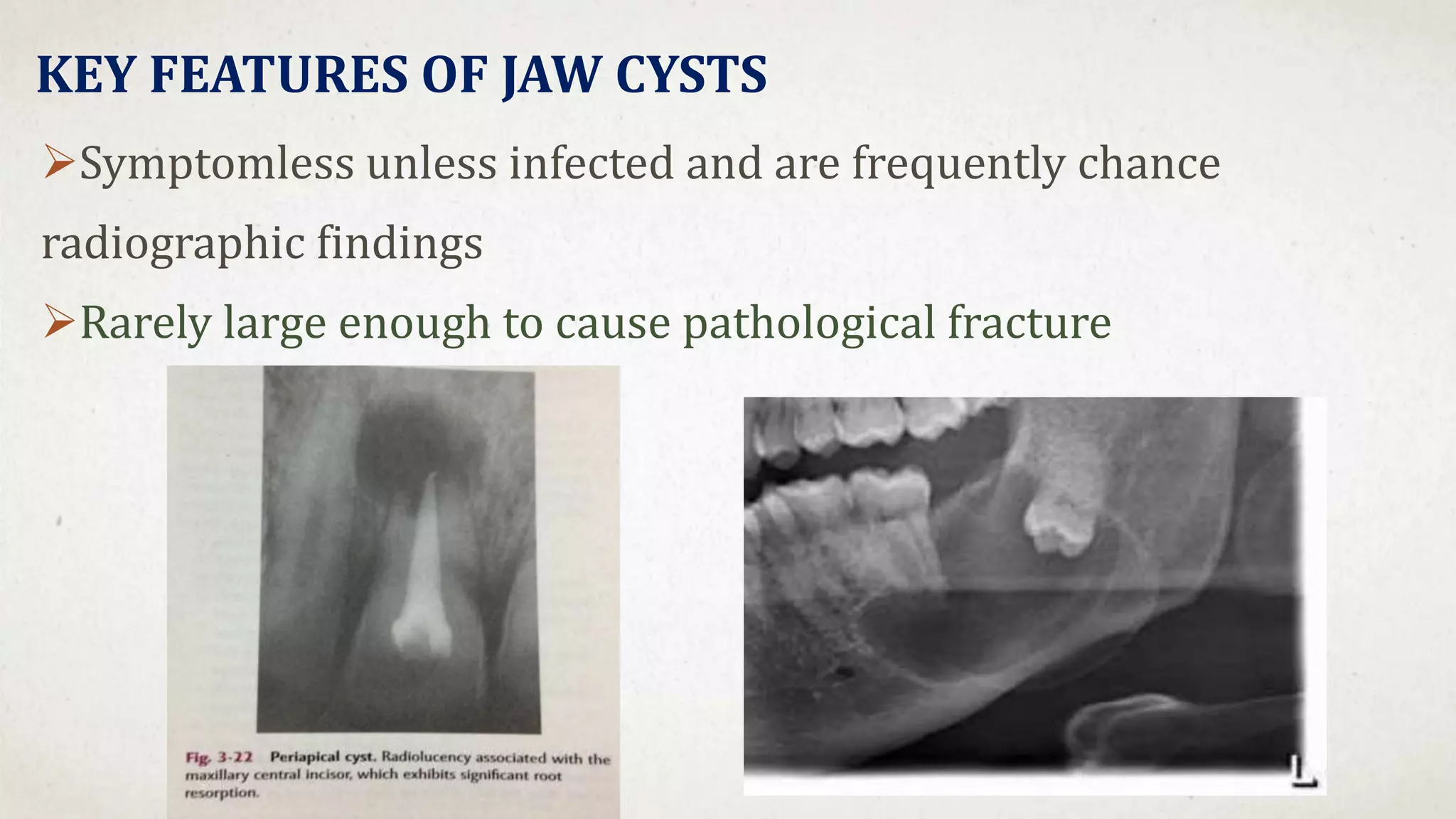 Cysts of oral and maxillofacial region by dr. maryam salman | PPTX