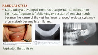 Cysts of oral and maxillofacial region by dr. maryam salman | PPTX