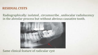 Cysts of oral and maxillofacial region by dr. maryam salman | PPTX