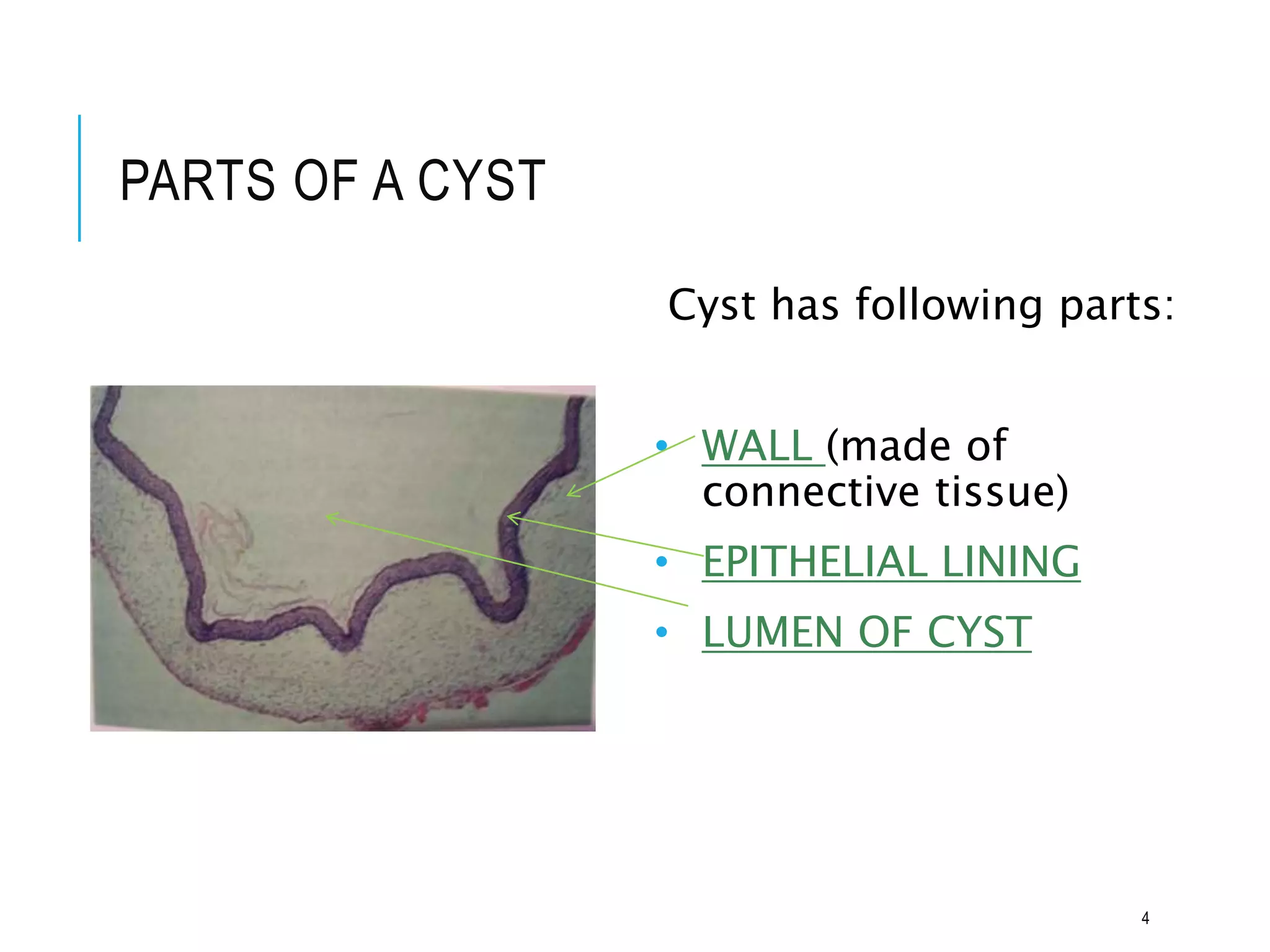 Cysts of Oral Cavity | PPTX