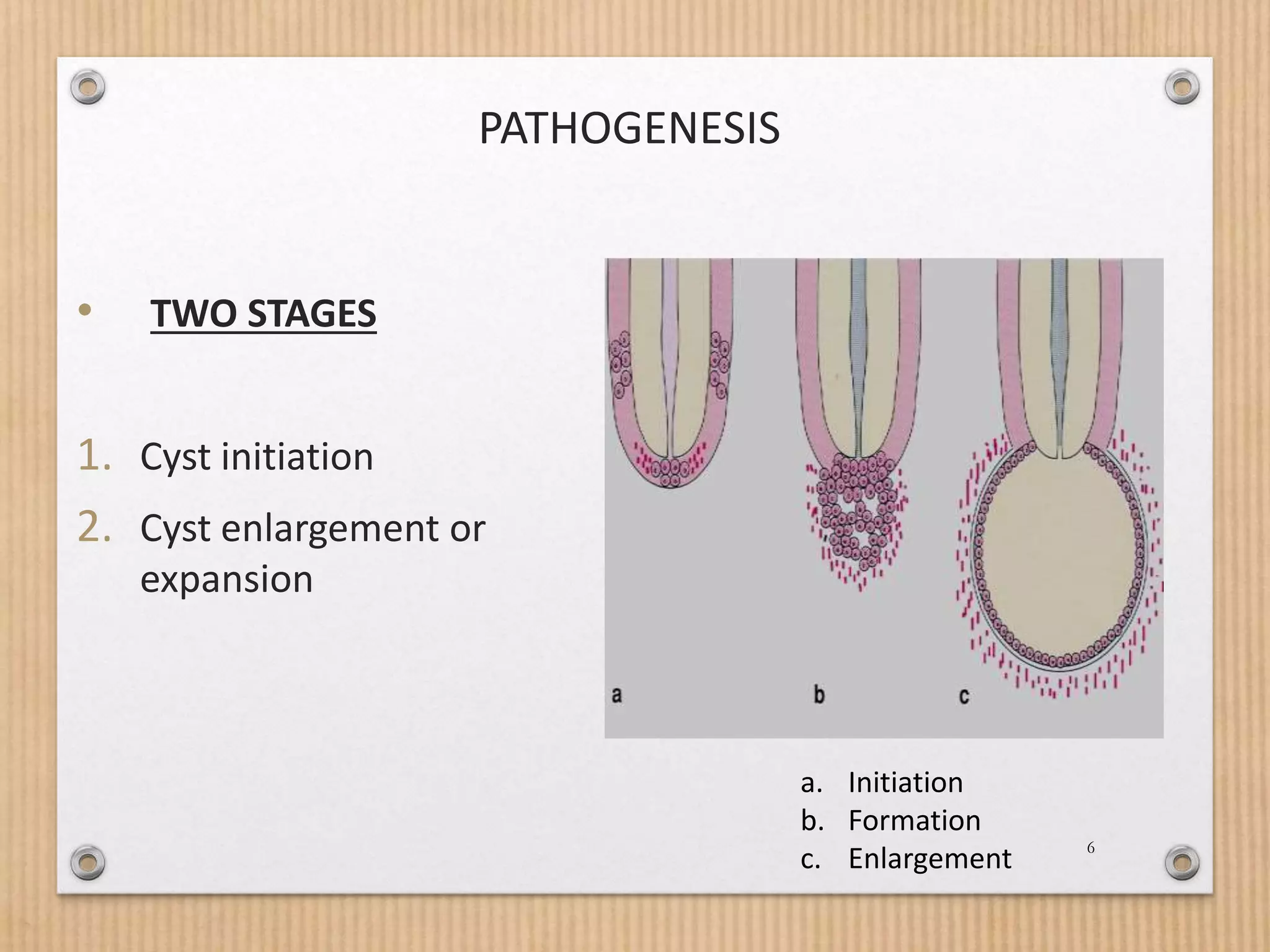 Cysts of Oral Cavity | PPTX