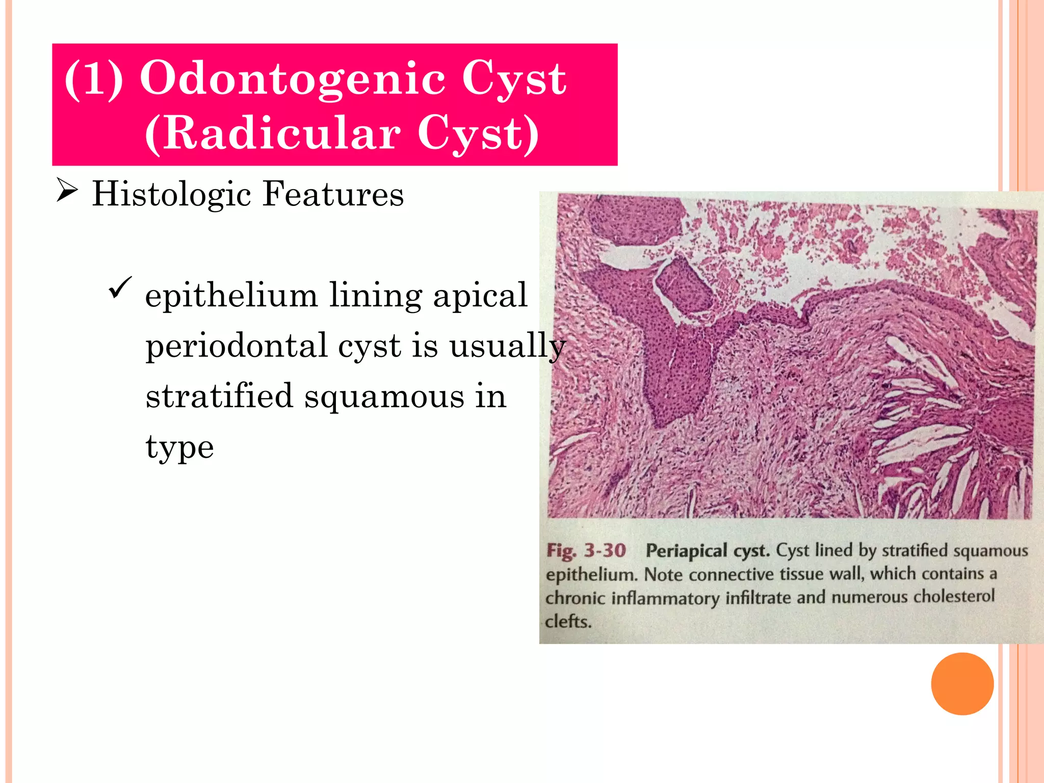 Cysts of oral region (5) | PPT